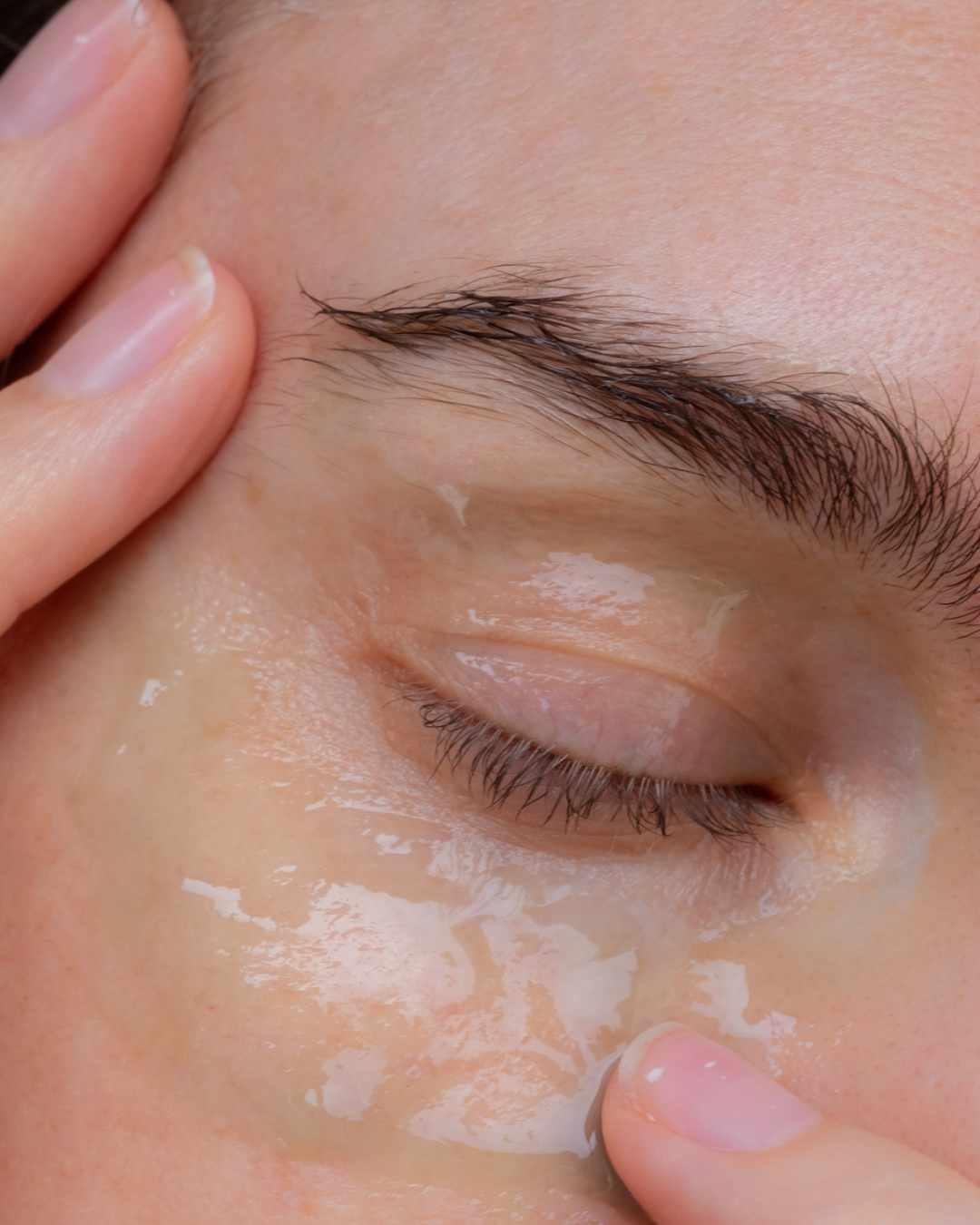 Dehydration and Breakouts: Why Tight Skin Can Still Break Out – NAYA