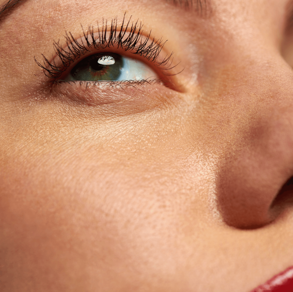 Skin Purging: What It Is & How to Handle the Initial Flare-Up – NAYA