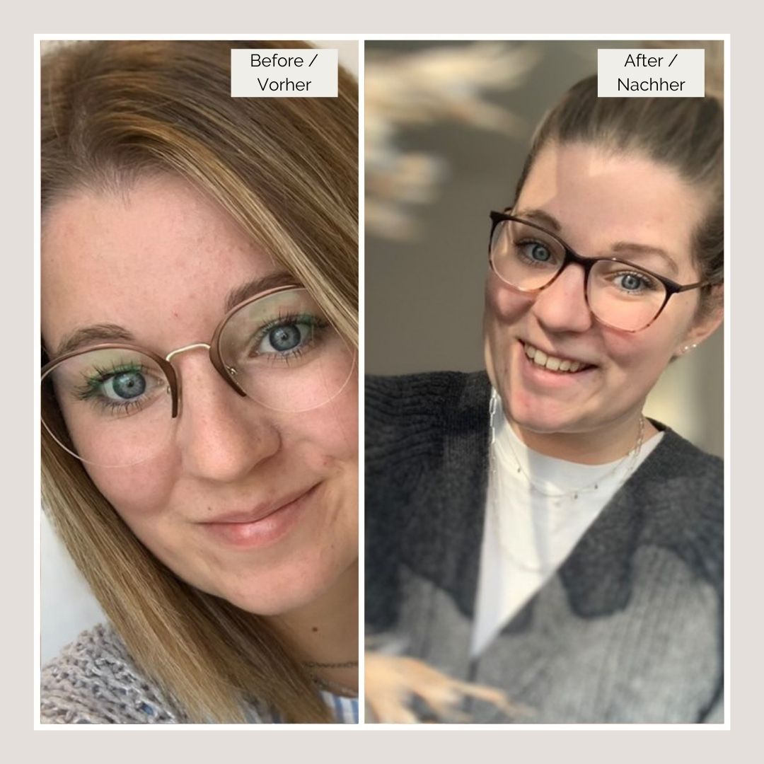 NAYA Transformation Stories: Real Results & Radiant Skin